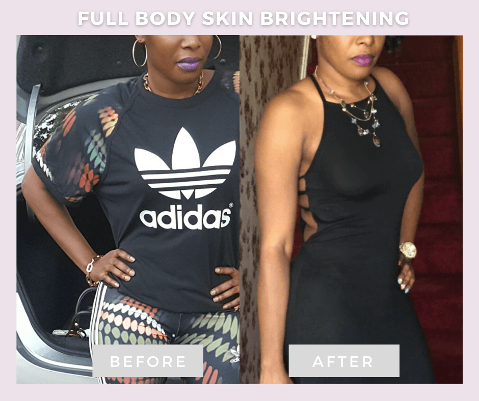 Home|Skincare Spa Treatments For Acne,Skin Lightening & facials ...