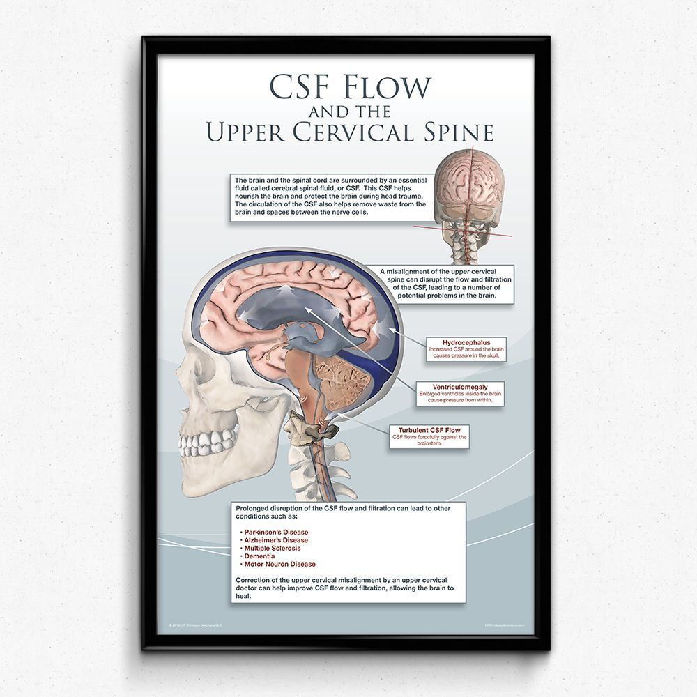 Upper Cervical Posters