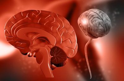 lateral medullary infarction (Wallenberg syndrome)