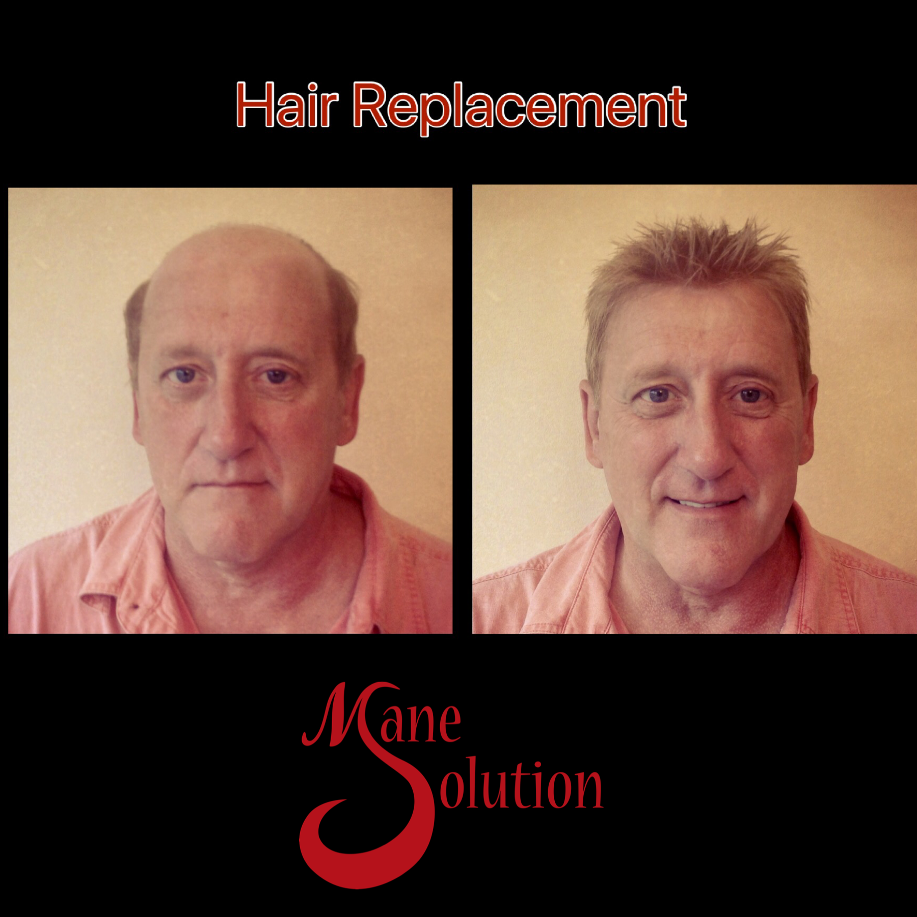 Hair Replacement & Hair Loss Treatment: Latham, NY | Mane Solution