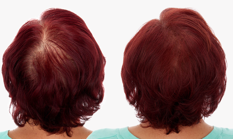 Mane Strands | Mane Solution
