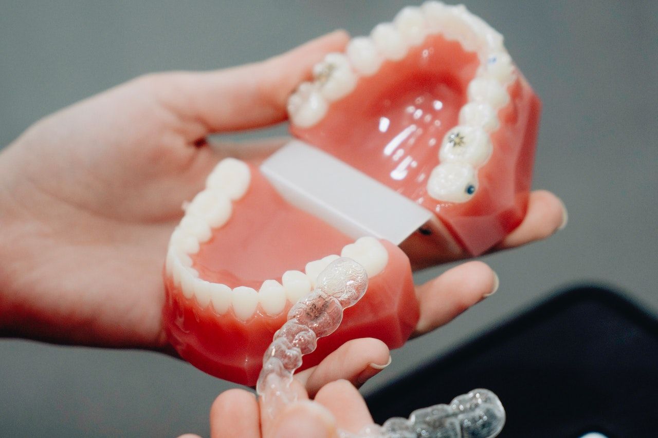 A Guide to Invisalign: How it Works, Benefits, and What to Expect