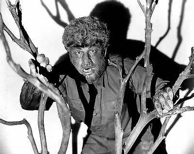 Wolf Bites! Terrifying Facts about The Wolf Man