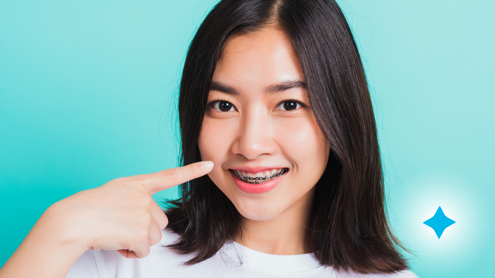 Why Are Brackets on My Braces Placed Differently? Understanding the ...