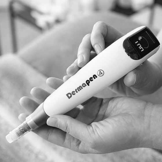 Extending Dermapen Super Special Until July 12!!!