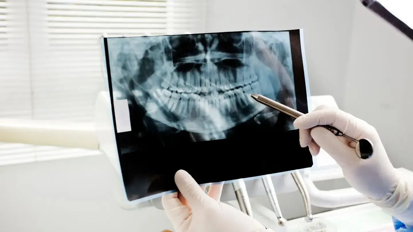 Facial Swelling from a Tooth Infection? When to Seek Emergency Dental ...