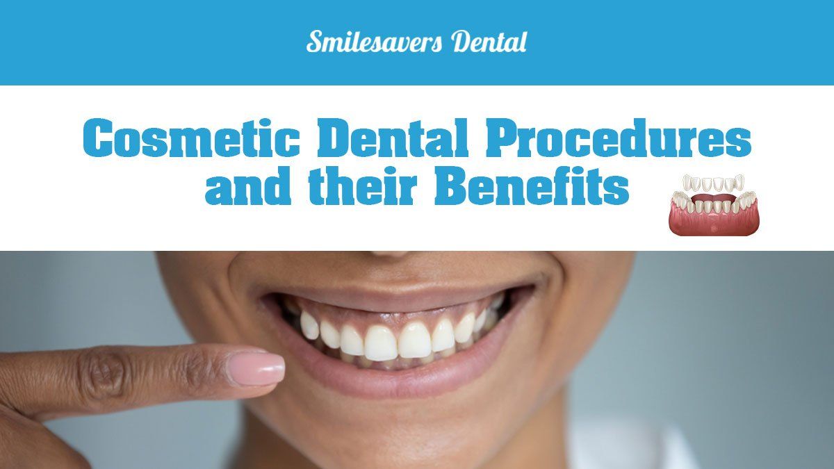 Cosmetic Dental Procedures and Their Benefits