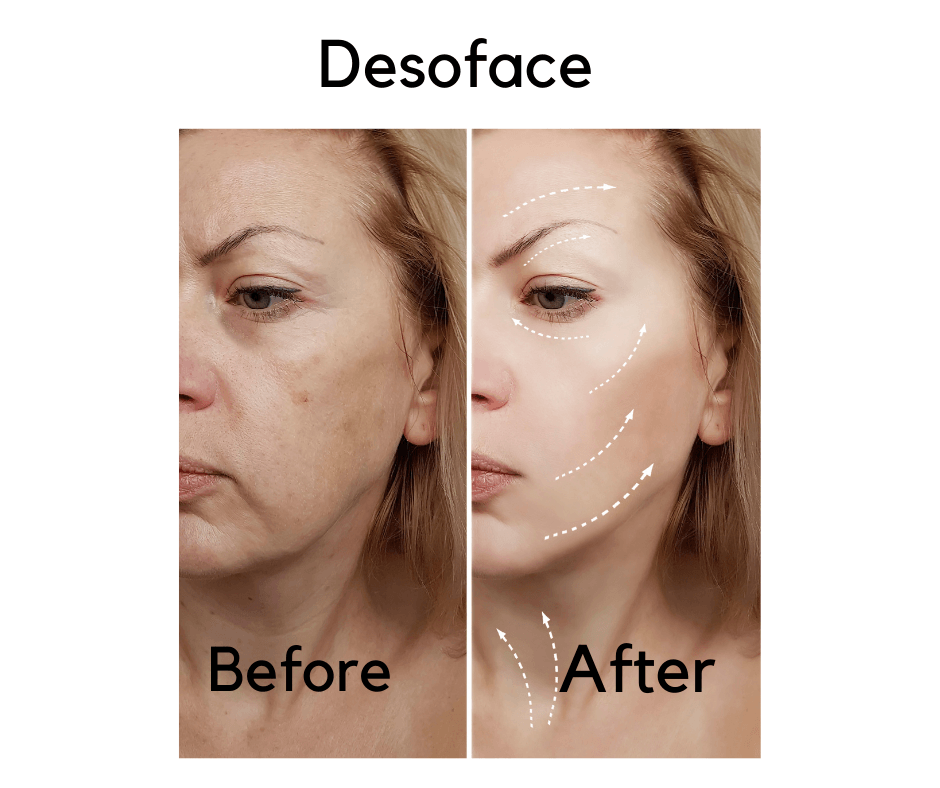 Before And After Results