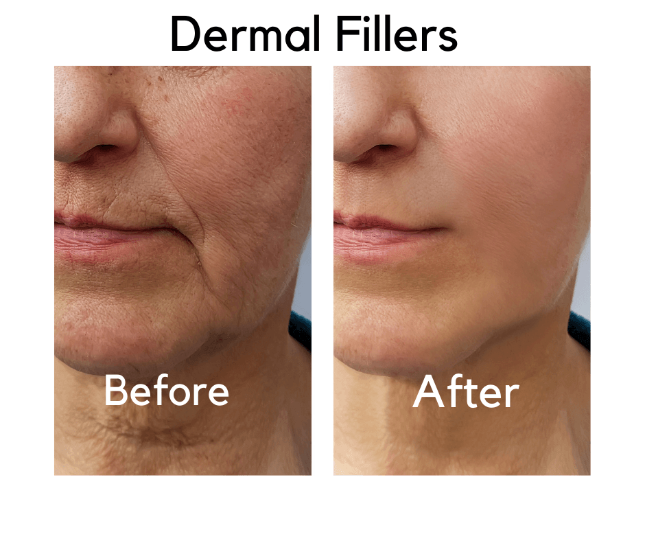 Before And After Results