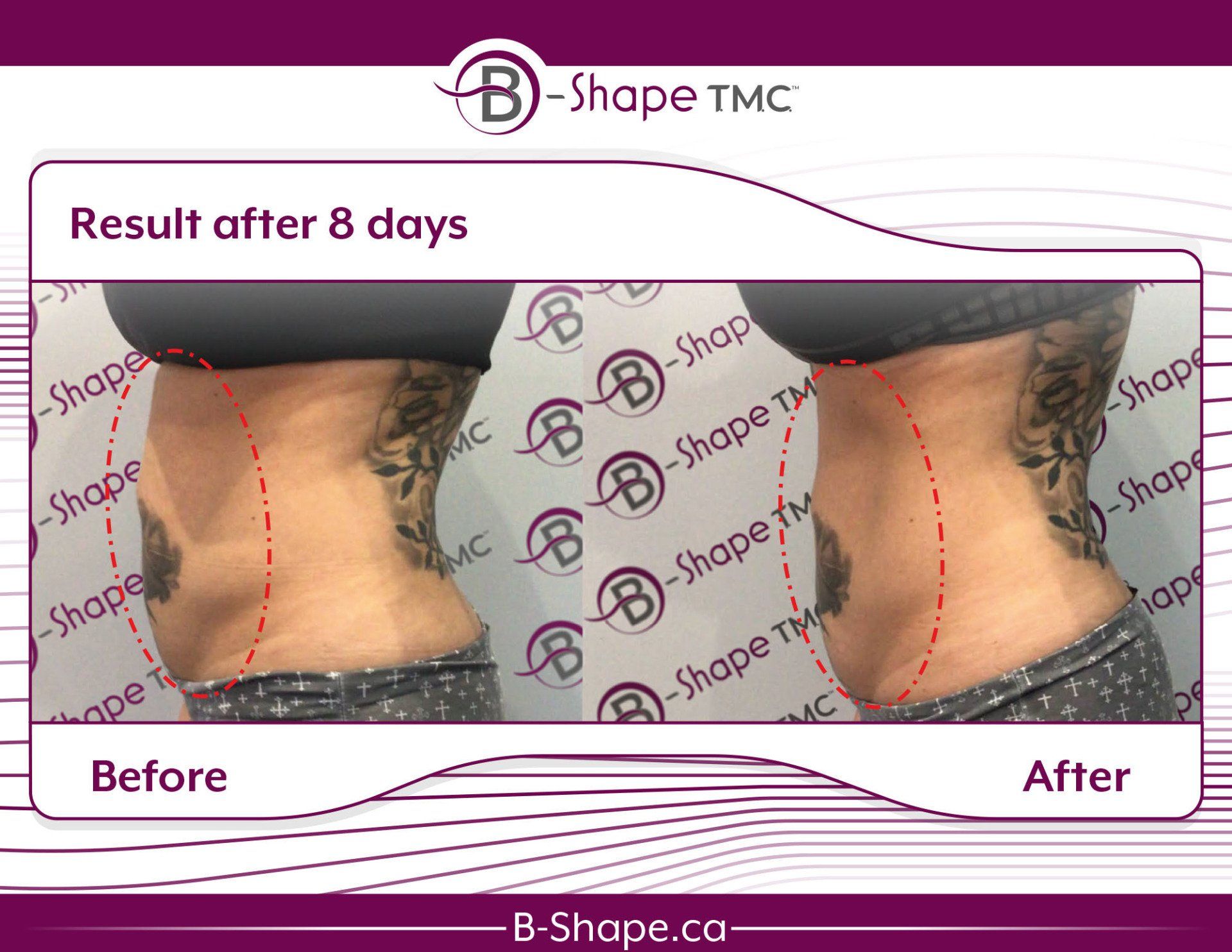About Our Innovative Treatment & How It Works | B-Shape T.M.C.