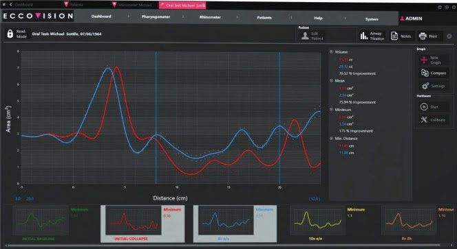 Our Technology | Smile For Life - Wenatchee Dentistry