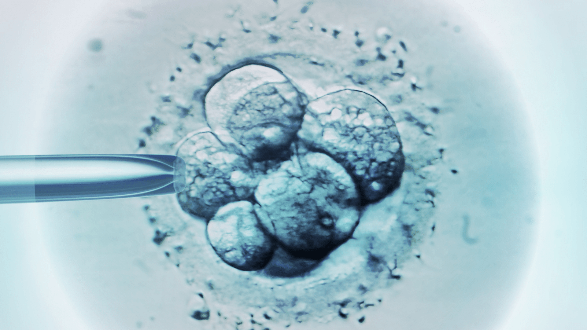 What is the IVF Process Step-by-Step?