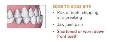 Invisalign Orthodontics - Tampa, FL - The Hyde Park Center For ...