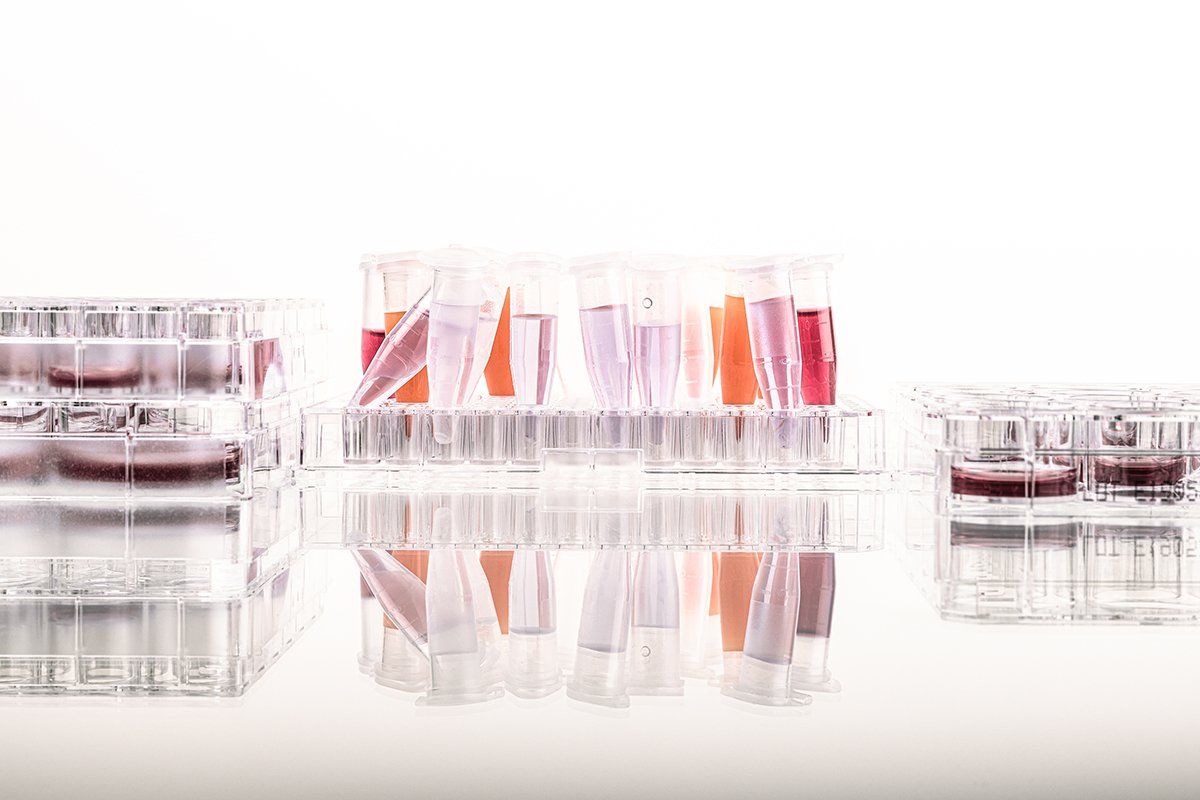 New group leader at the Clinical and Experimental Endocrinology lab