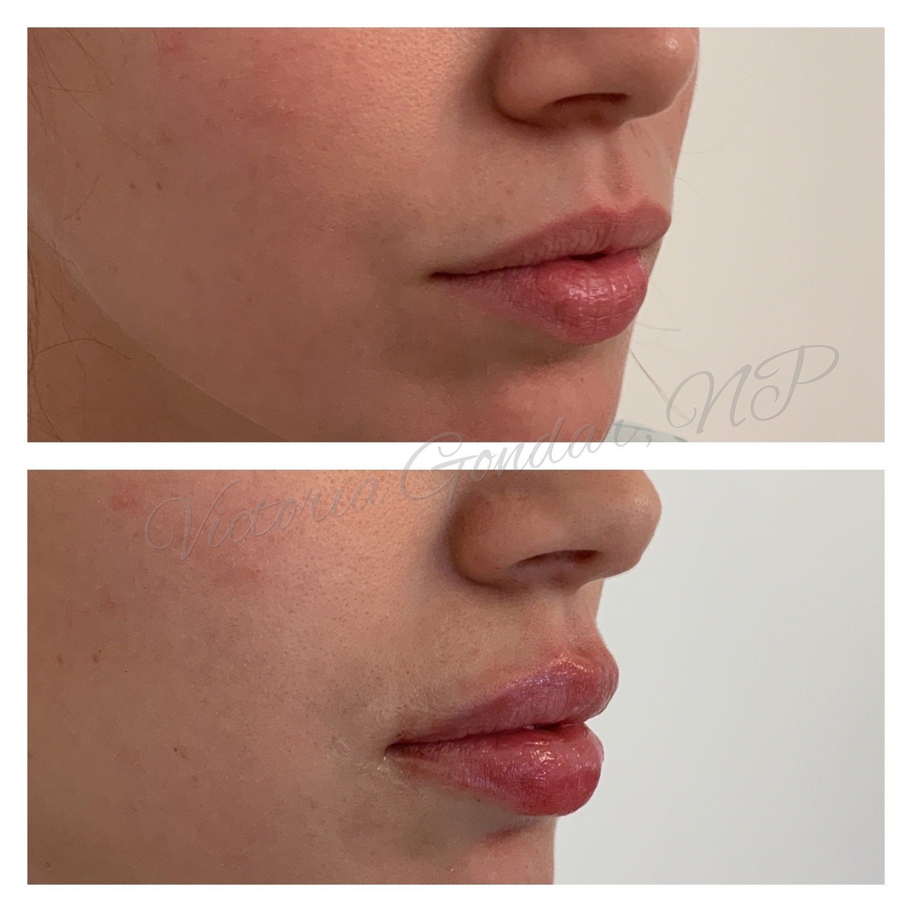 Victoria Aesthetics LLC - Clifton Park, NY - Photo Gallery