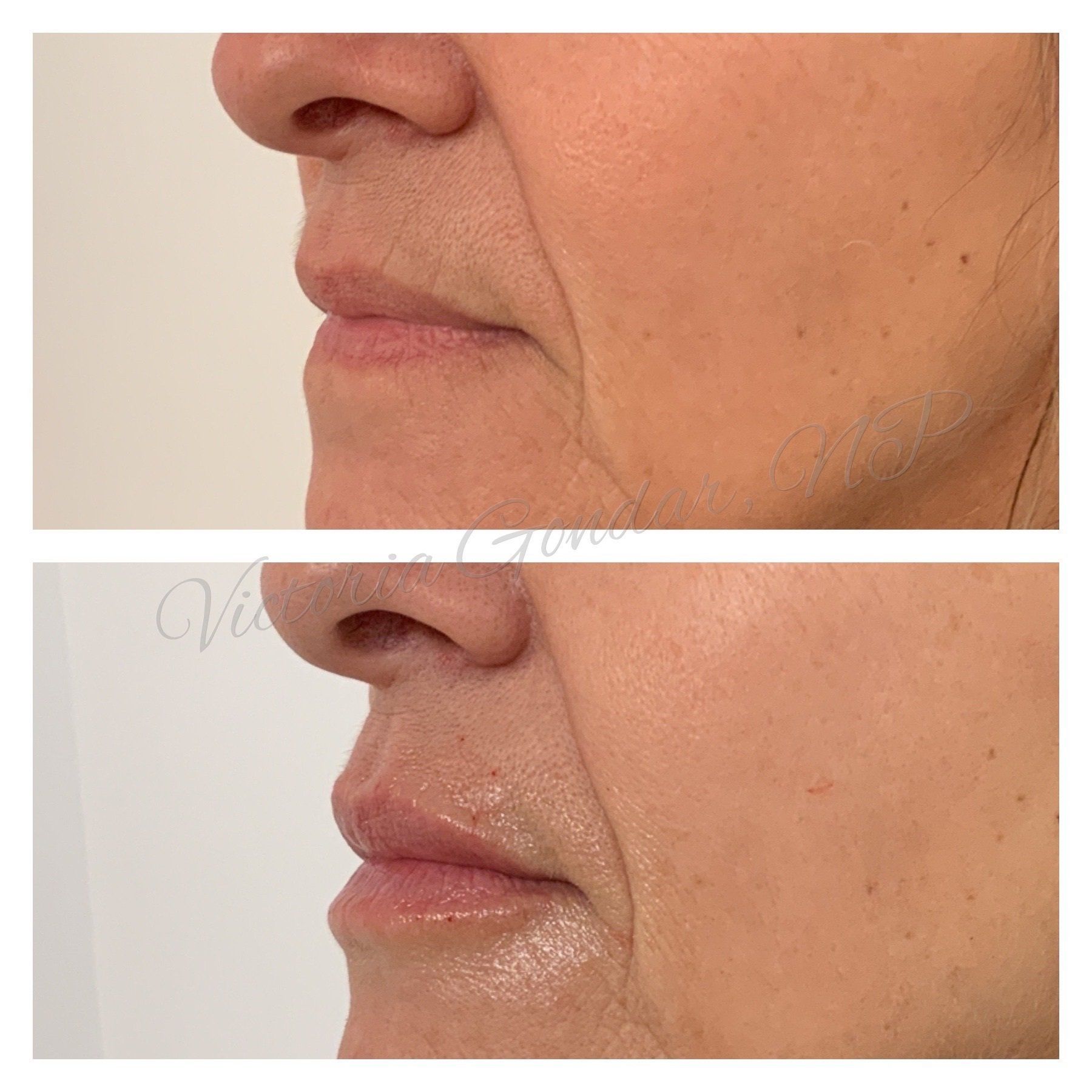 Victoria Aesthetics LLC - Clifton Park, NY - Photo Gallery