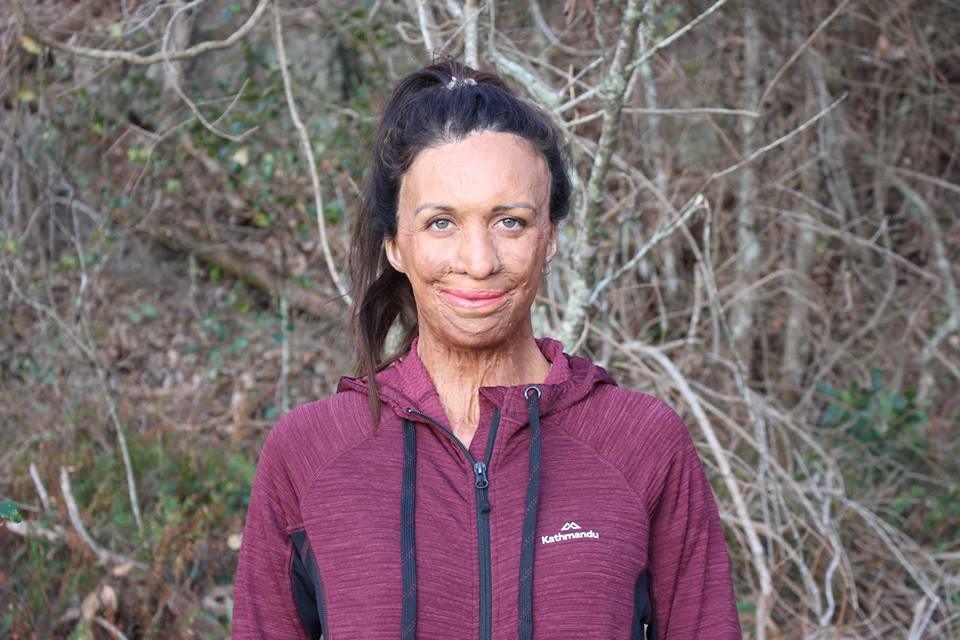 Turia Pitt announces return to competitive events as new ambassador for ...