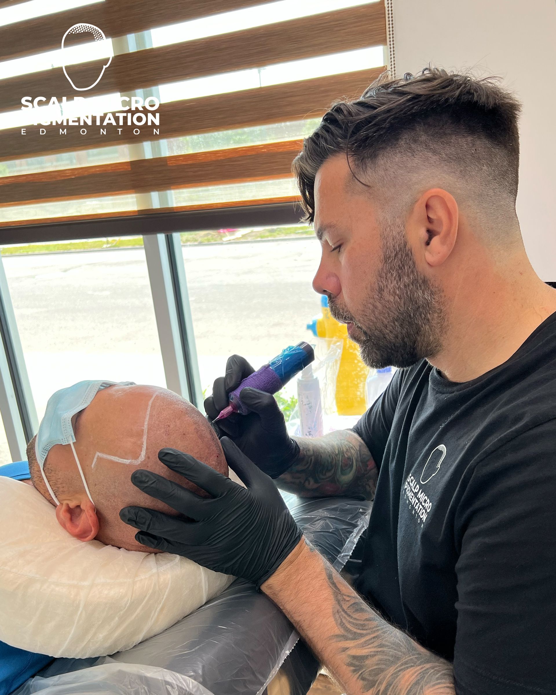 5 Reasons Why Women Should Choose Scalp Micropigmentation