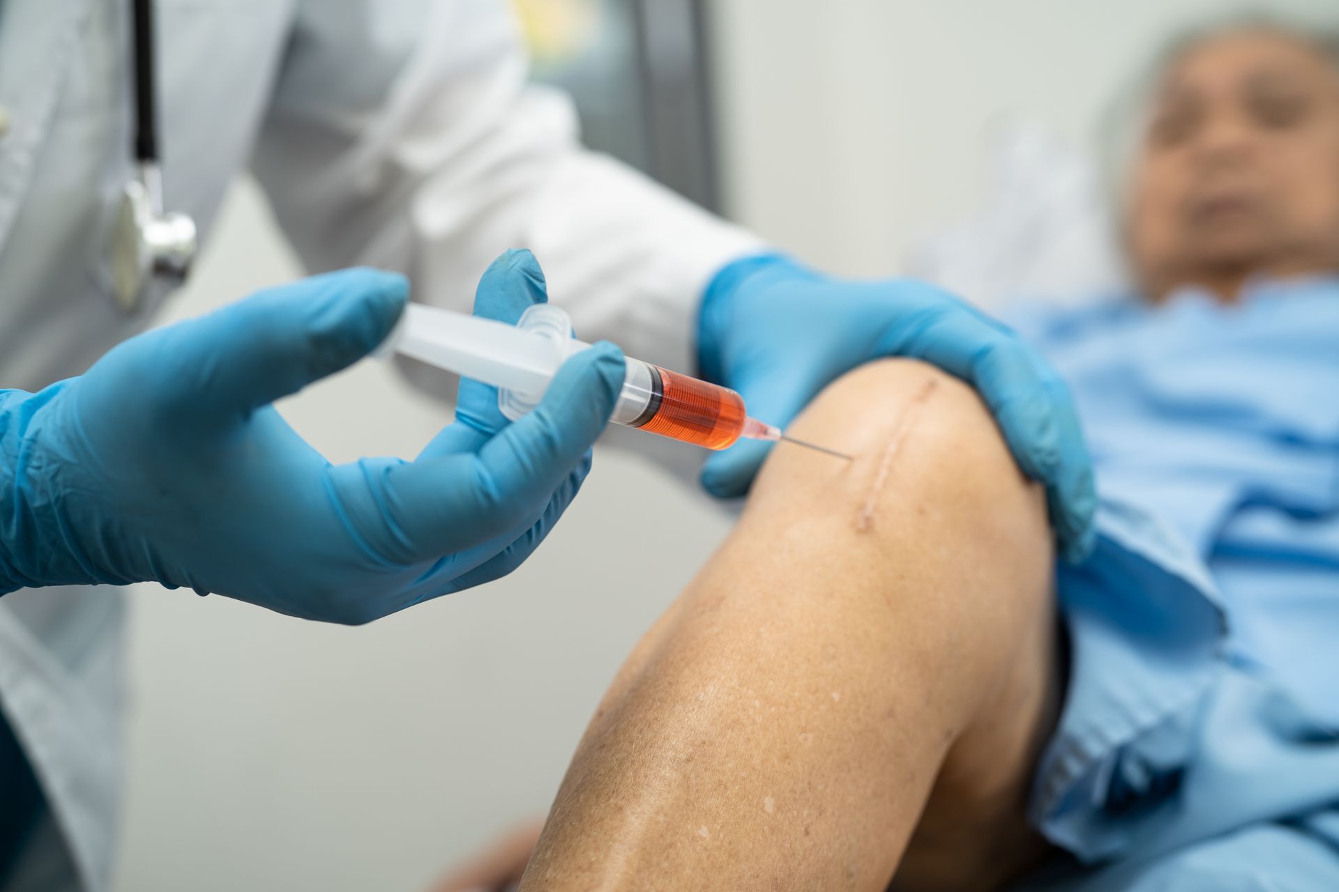 How Platelet Rich Plasma (PRP) Therapy Can Alleviate Joint Pain
