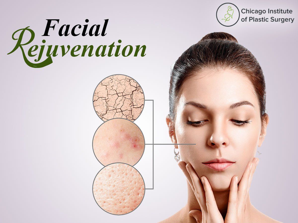 Facial Rejuvenation with Juvederm - Know How Juvederm Works Wonders for ...