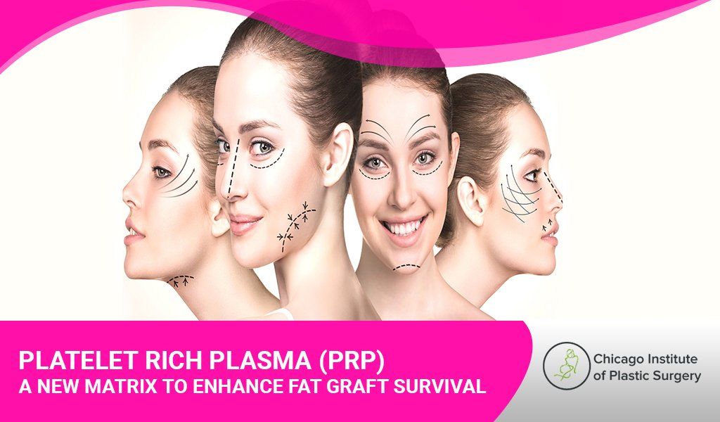 Platelet Rich Plasma (PRP) – a New Matrix to Enhance Fat Graft Survival