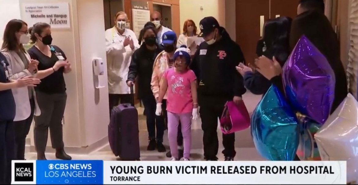 After Three Months, 7-Year-Old Burn Survivor from Oxnard Christmas Day ...