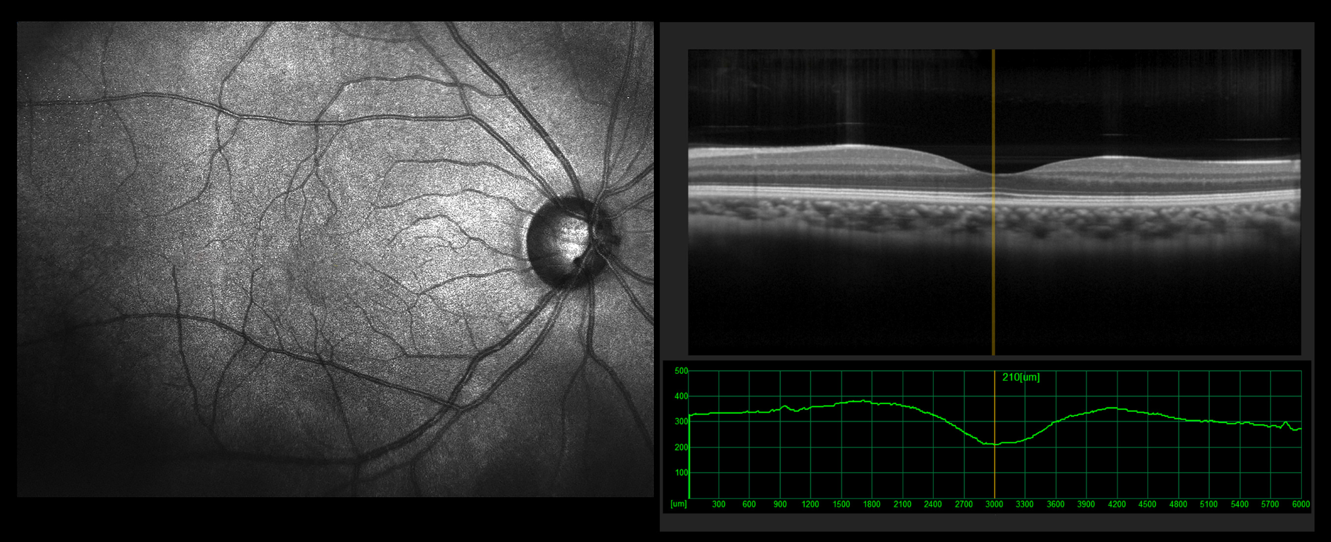 Top Benefits of Using Ophthalmic Image Management Software