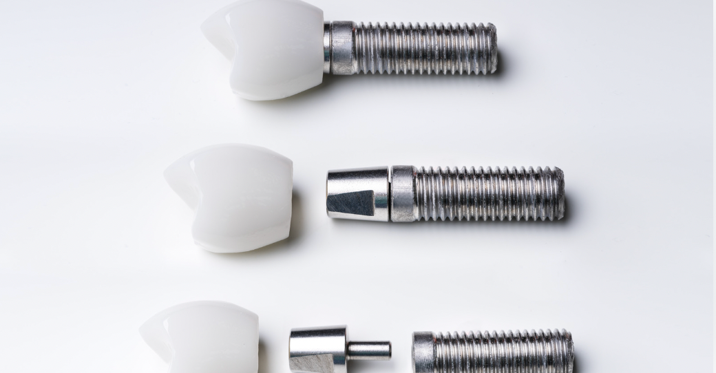 Mini Implants vs. Regular Implants: Which Is Better for Your Smile?