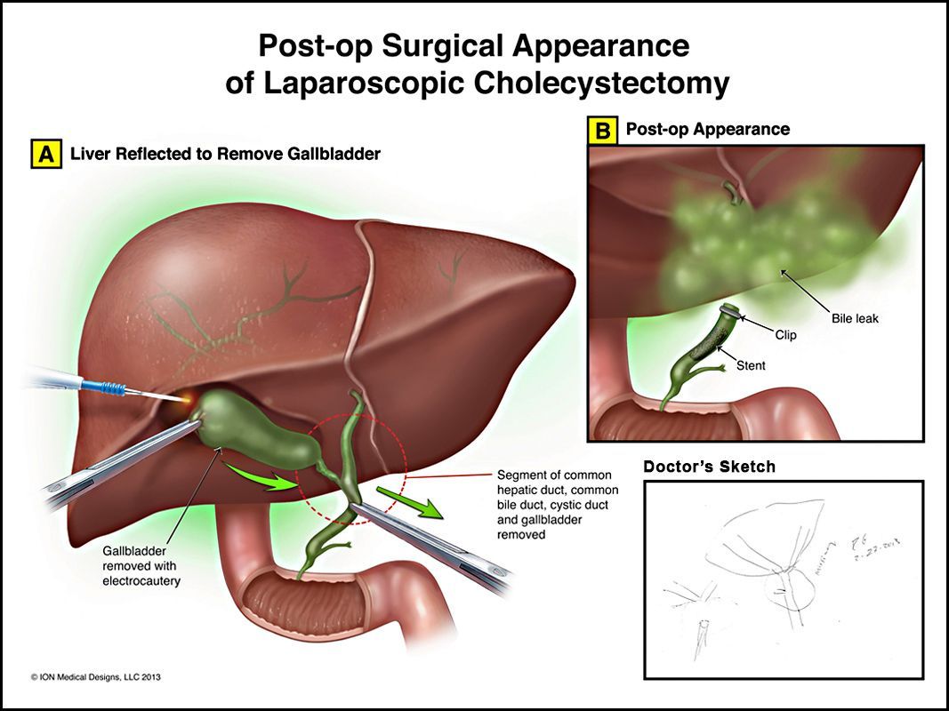 Showcase of Accurate and Visual Medical Illustrations | Ion Medical Designs